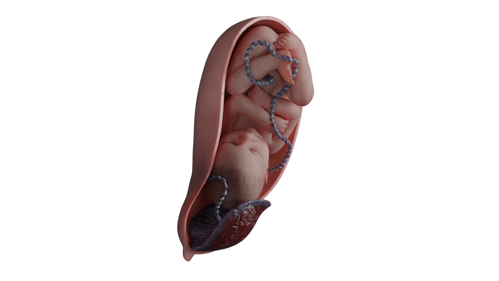 Placenta previa: classification, causes, symptoms, treatment